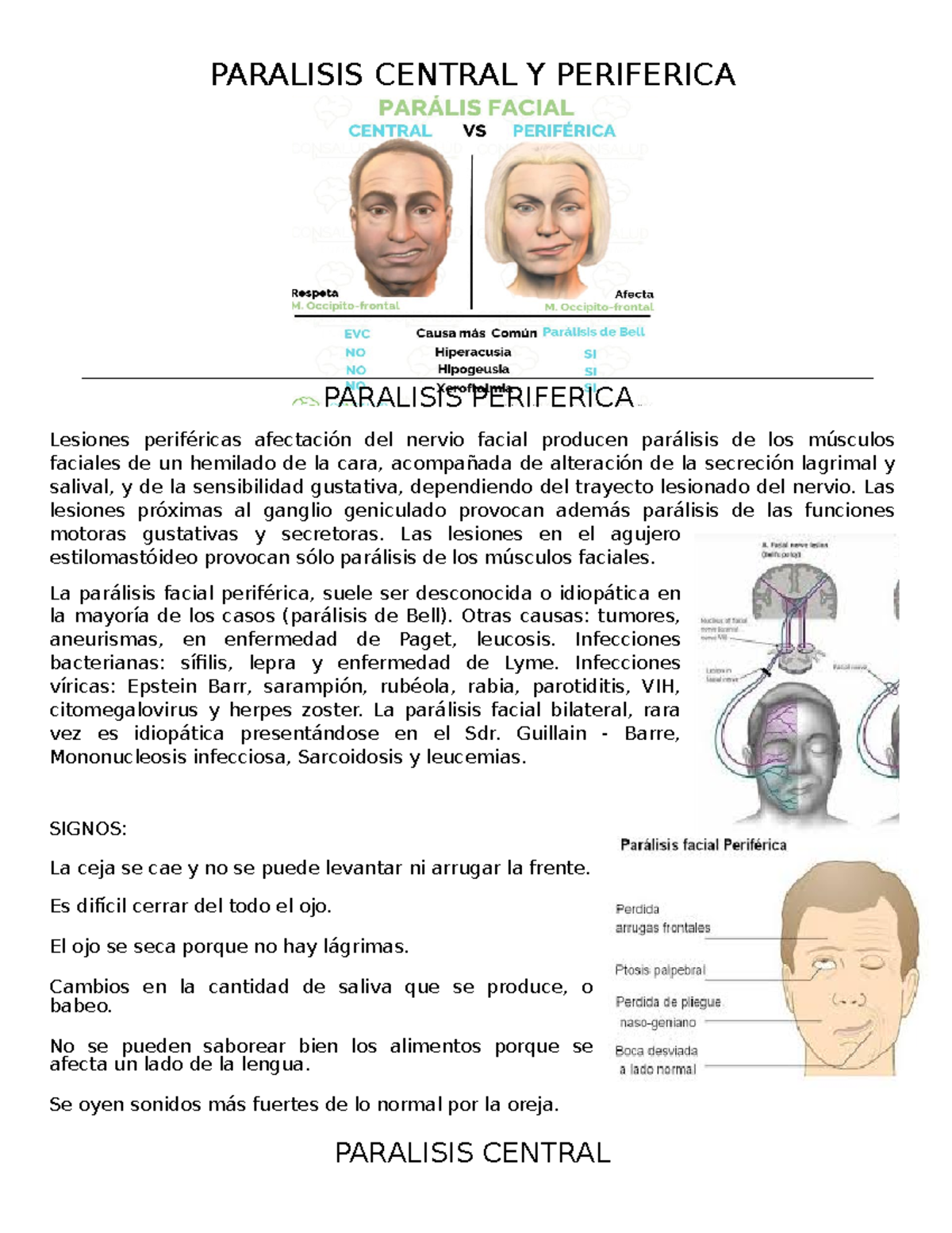 Paralisis Central Y Periferica - PARALISIS CENTRAL Y PERIFERICA ...