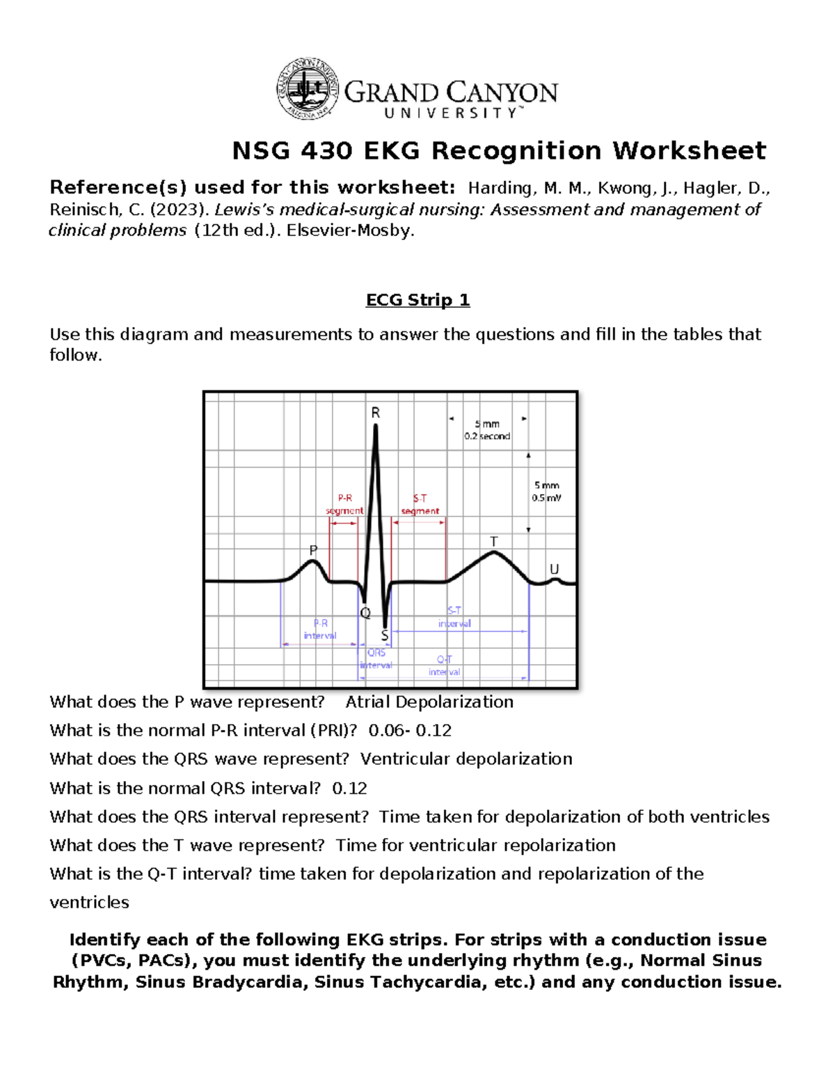 NSG-430-RS-ECG Worksheet - NSG 430 EKG Recognition Worksheet Reference ...