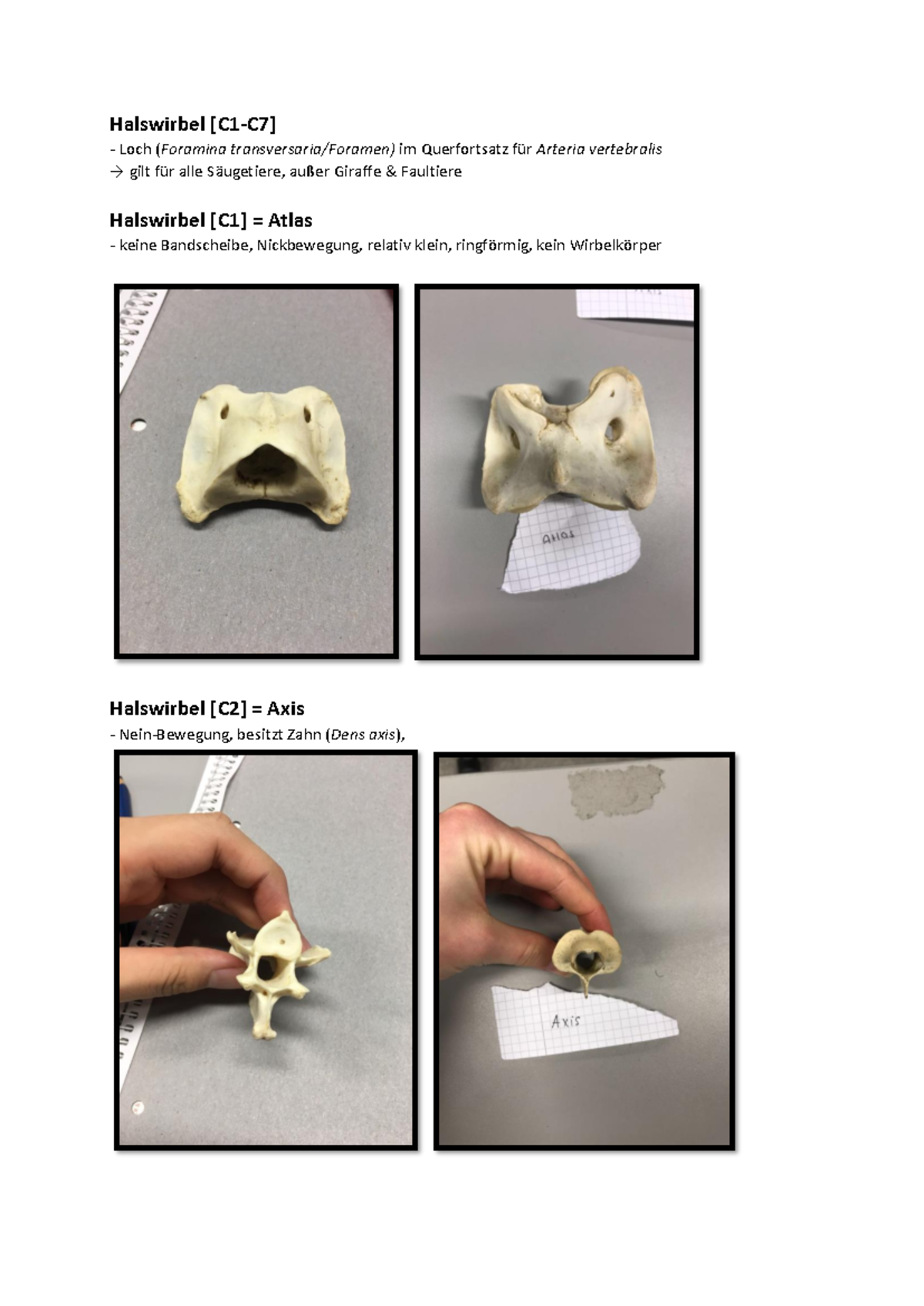 Knochen Zusammenfassung Teil 1 - Halswirbel [C1-C7] Loch ( Foramina ...