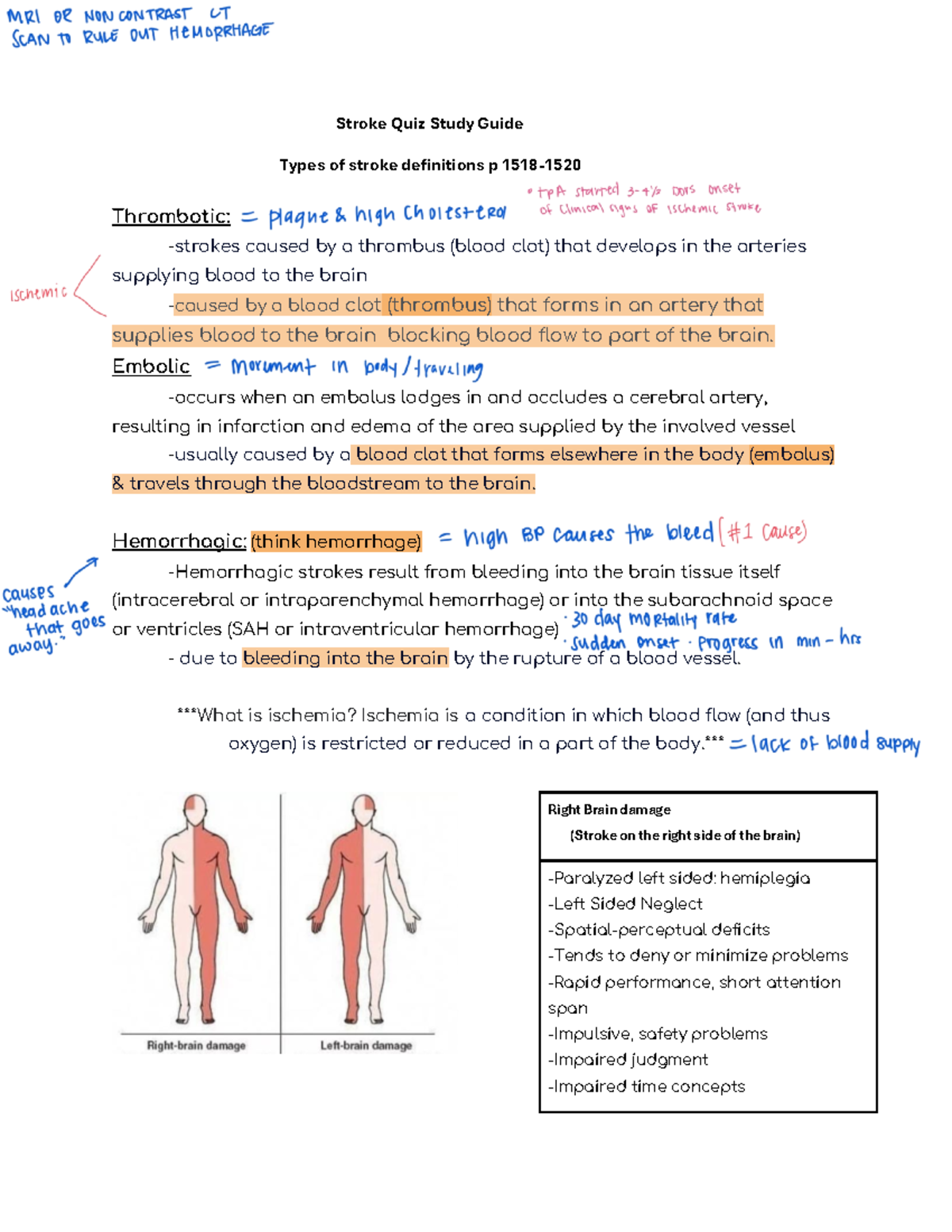 Study+guide+Stroke - Practice - Stroke Quiz Study Guide Types of stroke definitions p 1518- 1520 ...