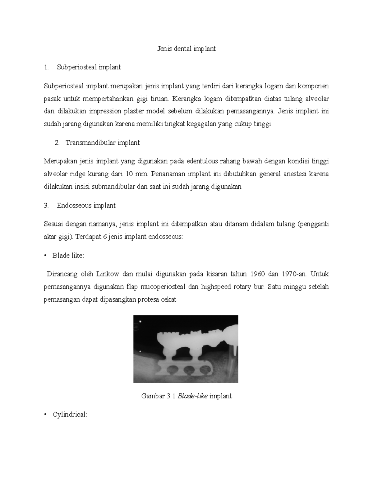 Jenis dental implant - Jenis dental implant Subperiosteal implant ...