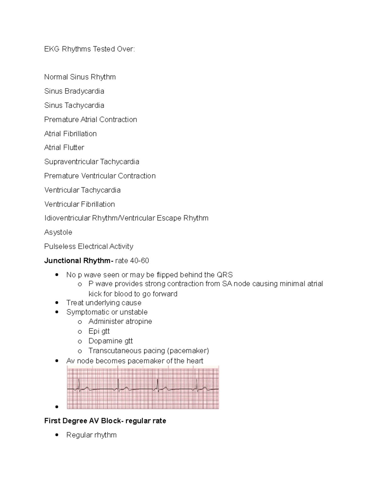 EKG Rhythms Tested Over S21 - EKG Rhythms Tested Over: Normal Sinus ...