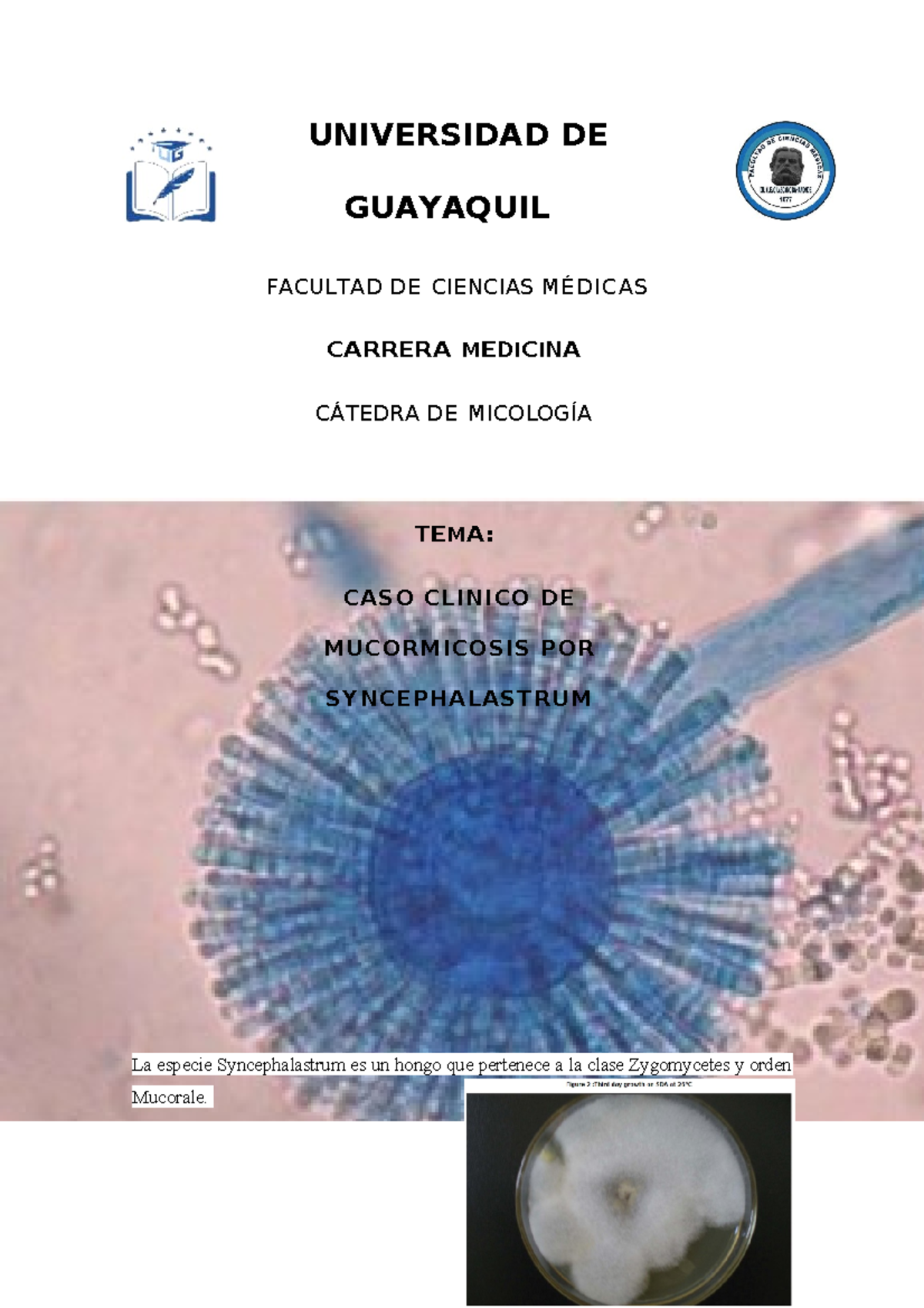 Mucormicosis POR Syncephalastrum - UNIVERSIDAD DE GUAYAQUIL FACULTAD DE ...