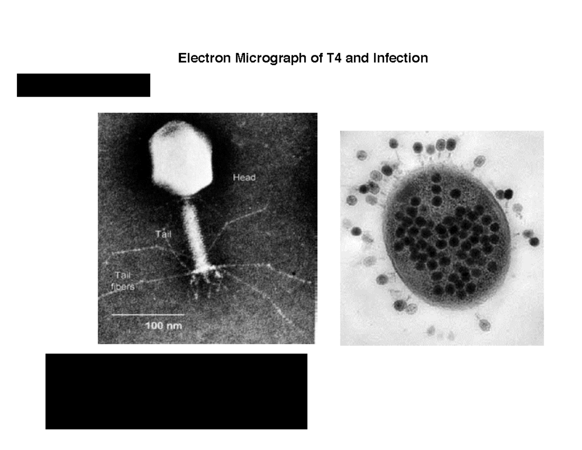 13 Phage Genetics - Electron Micrograph of T4 and Infection ...