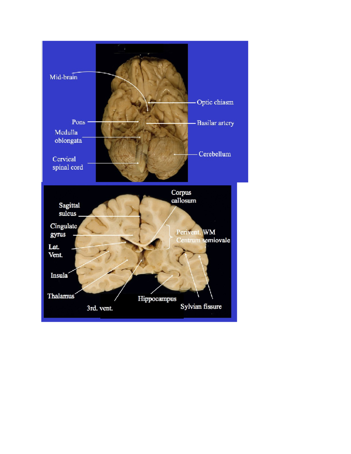 Bb exam 1 - Bb exam 1 - You may find the following optional animations ...