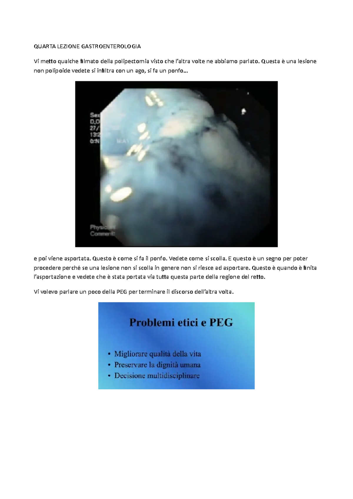 gastrostomia endoscopica percutanea (PEG) - QUARTA LEZIONE ...