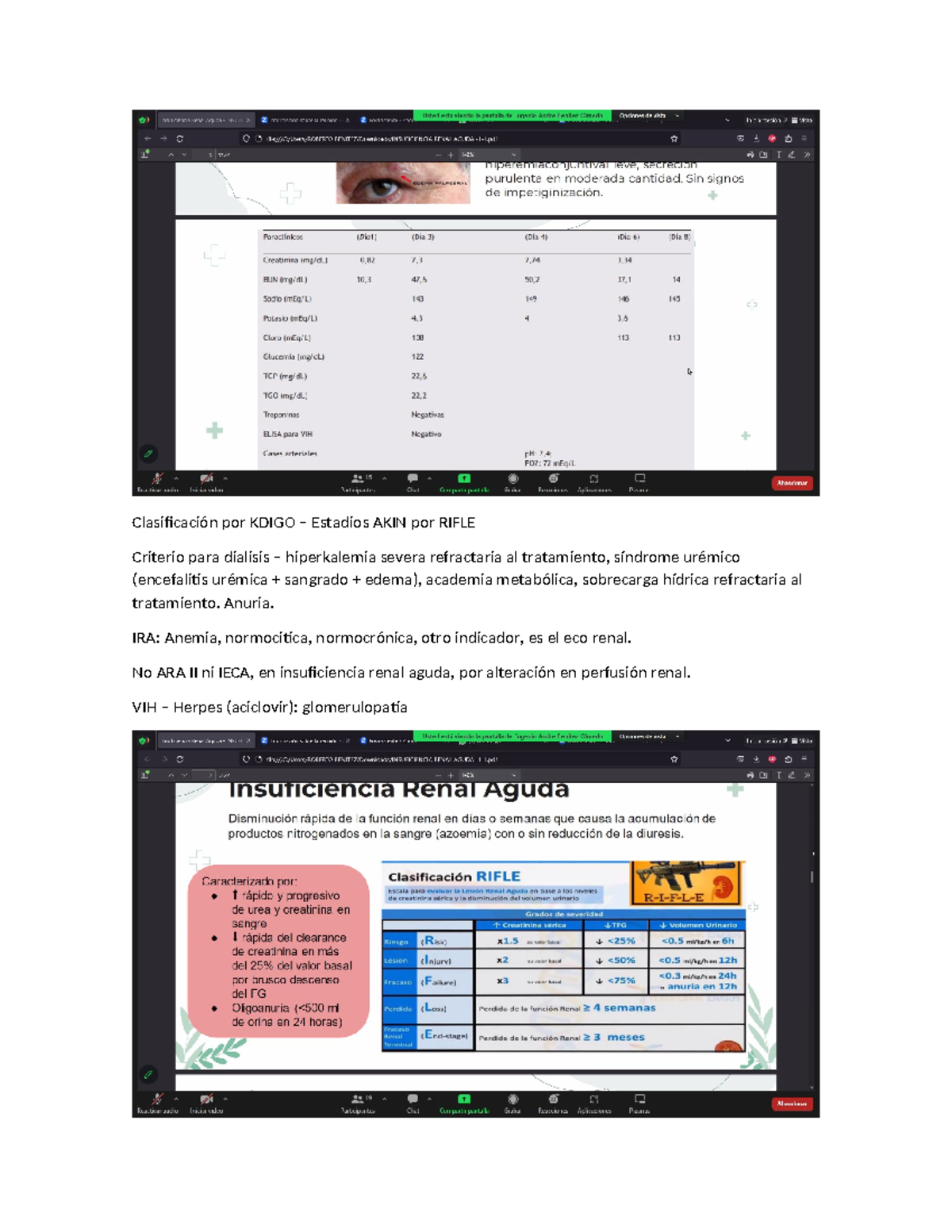 IRA - Clasificación por KDIGO – Estadios AKIN por RIFLE Criterio para ...