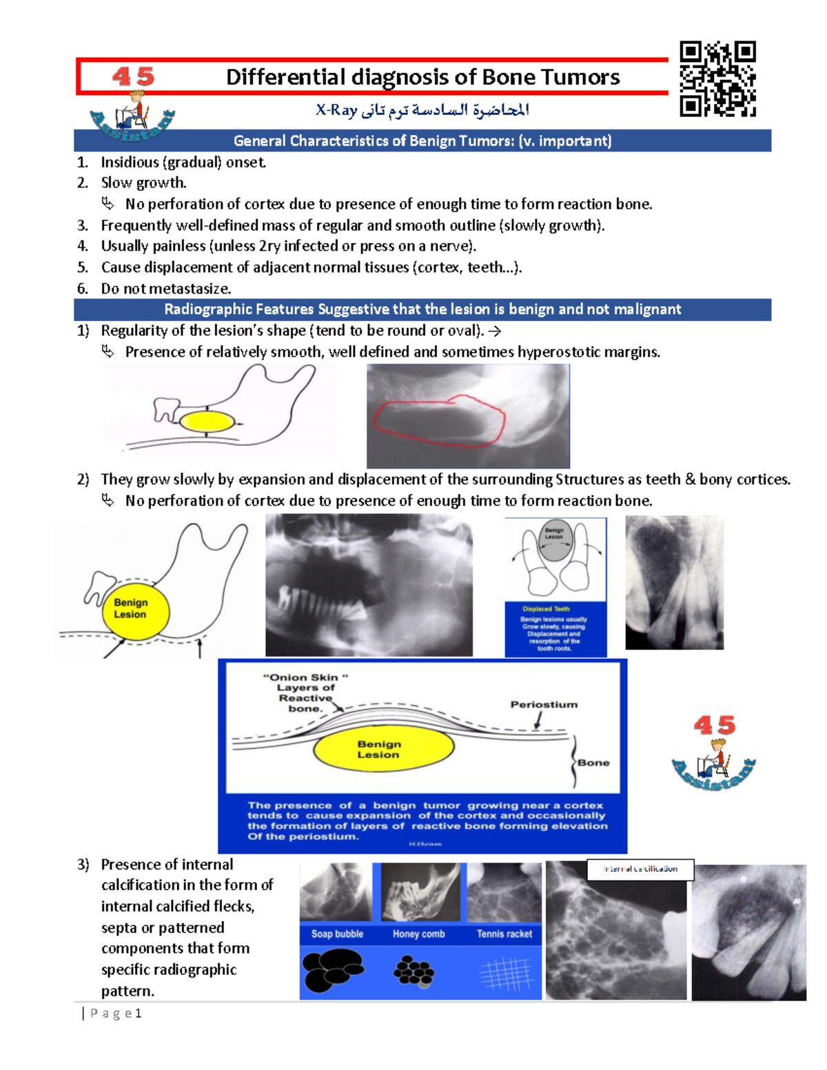 06- D.D of Tumors - Differential diagnosis of Bone Tumors X-Ray ...