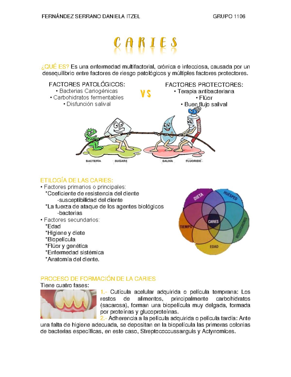 C A R I E S - caries - V S ¿QUÉ ES? Es una enfermedad multifactorial ...