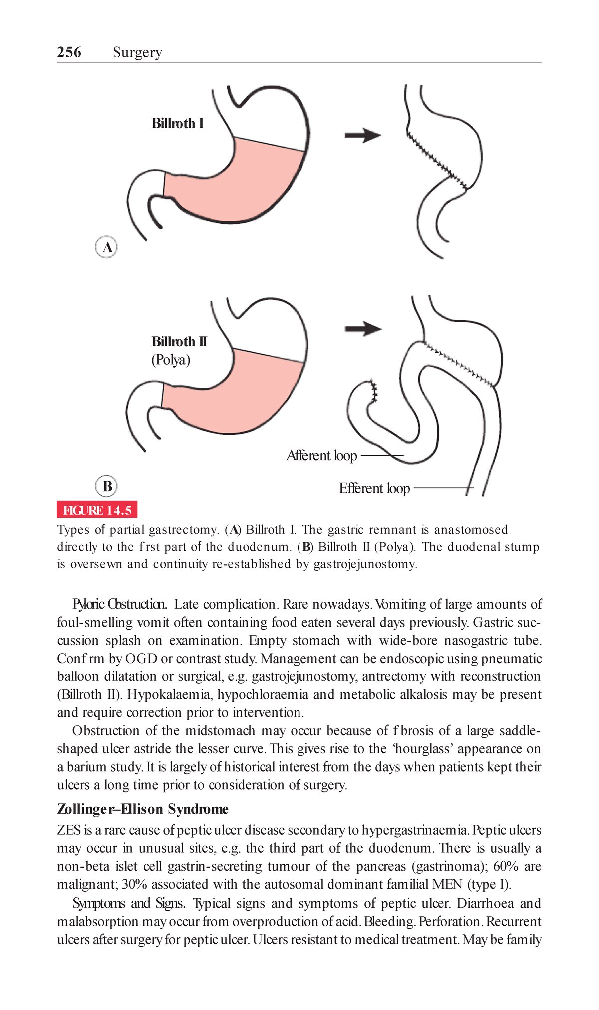 Churchill’s Pocketbooks Surgery – 5th Edition-32 - 256 Surgery Pyloric ...