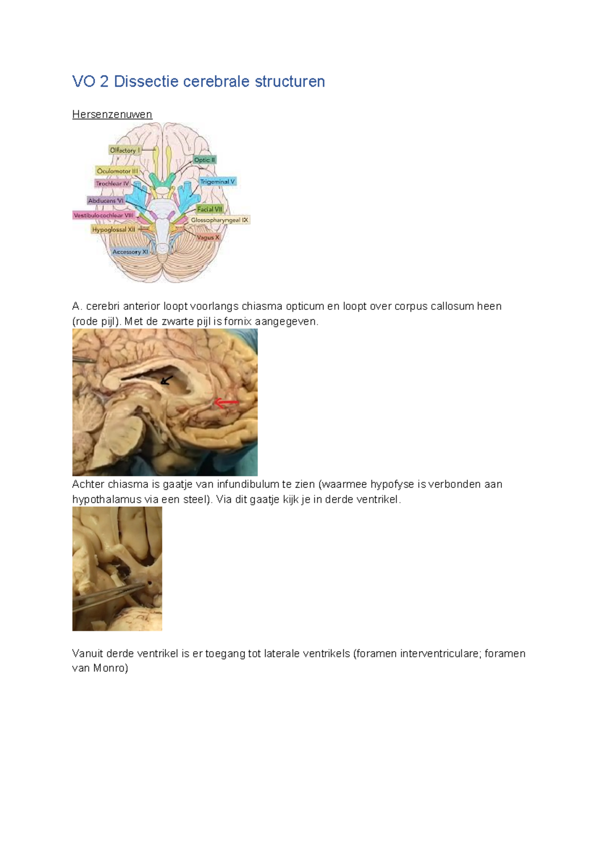 VO 2 Dissectie cerebrale structuren-2 - VO 2 Dissectie cerebrale ...