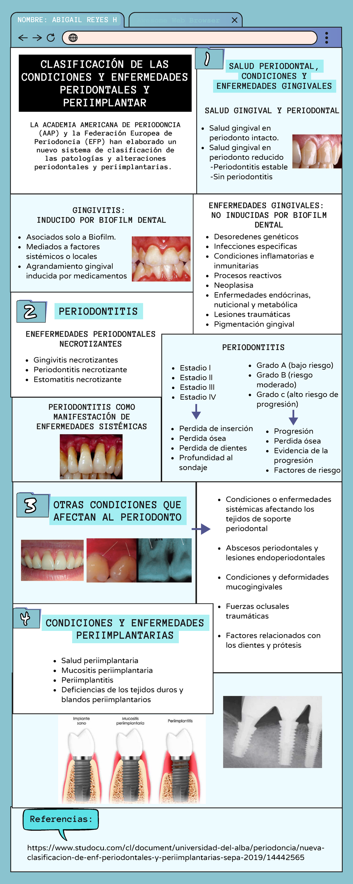 Infografía de Clasificacion de las enfermedades periodontales - 11 22 ...