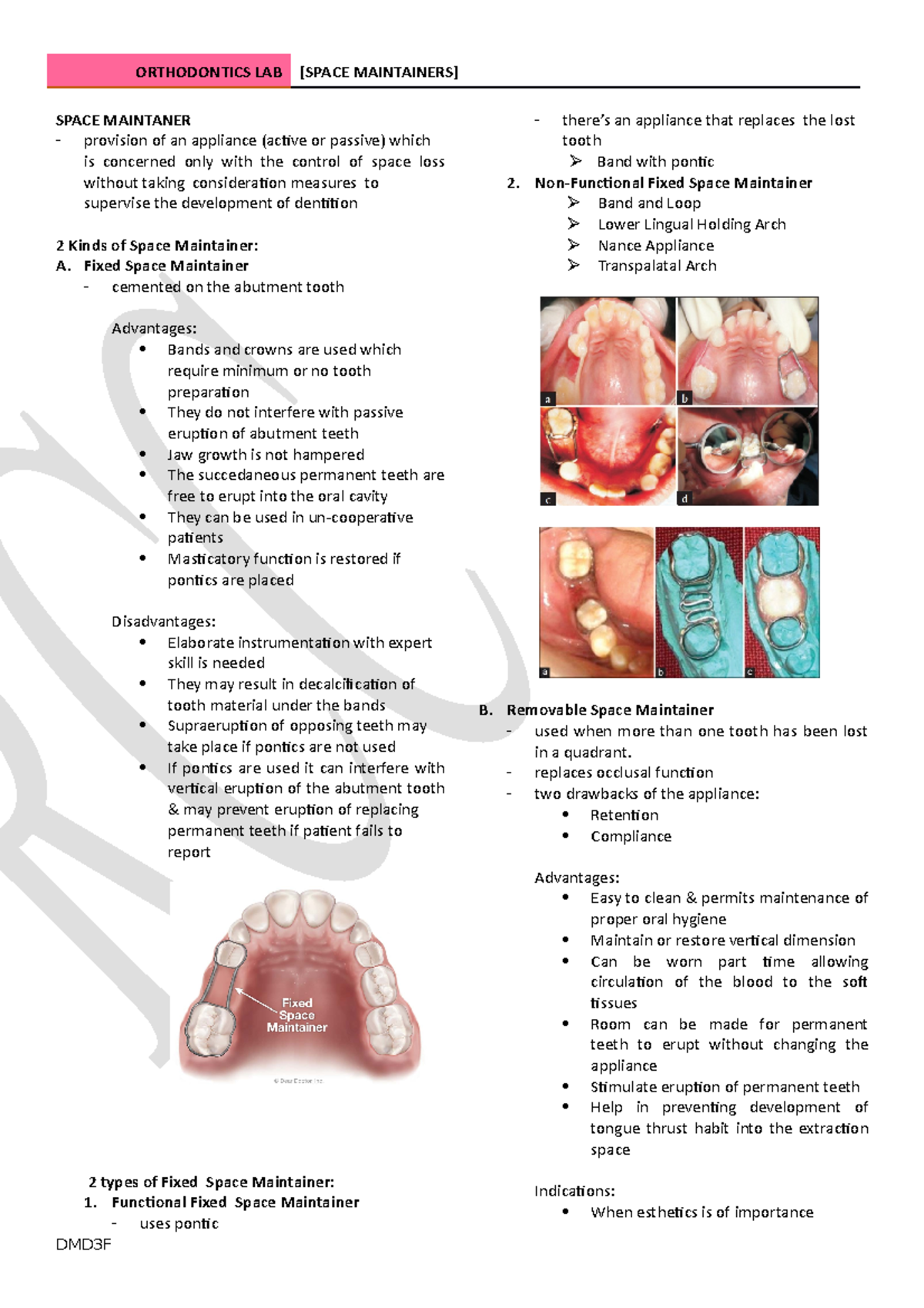 Ortho - Space Maintainer - ORTHODONTICS LAB [SPACE MAINTAINERS] SPACE ...
