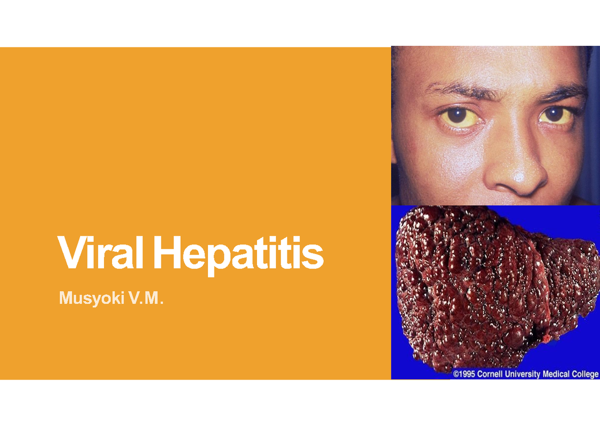 Guiding notes Hepatitis 2023 - Viral Hepatitis Musyoki V. Session ...