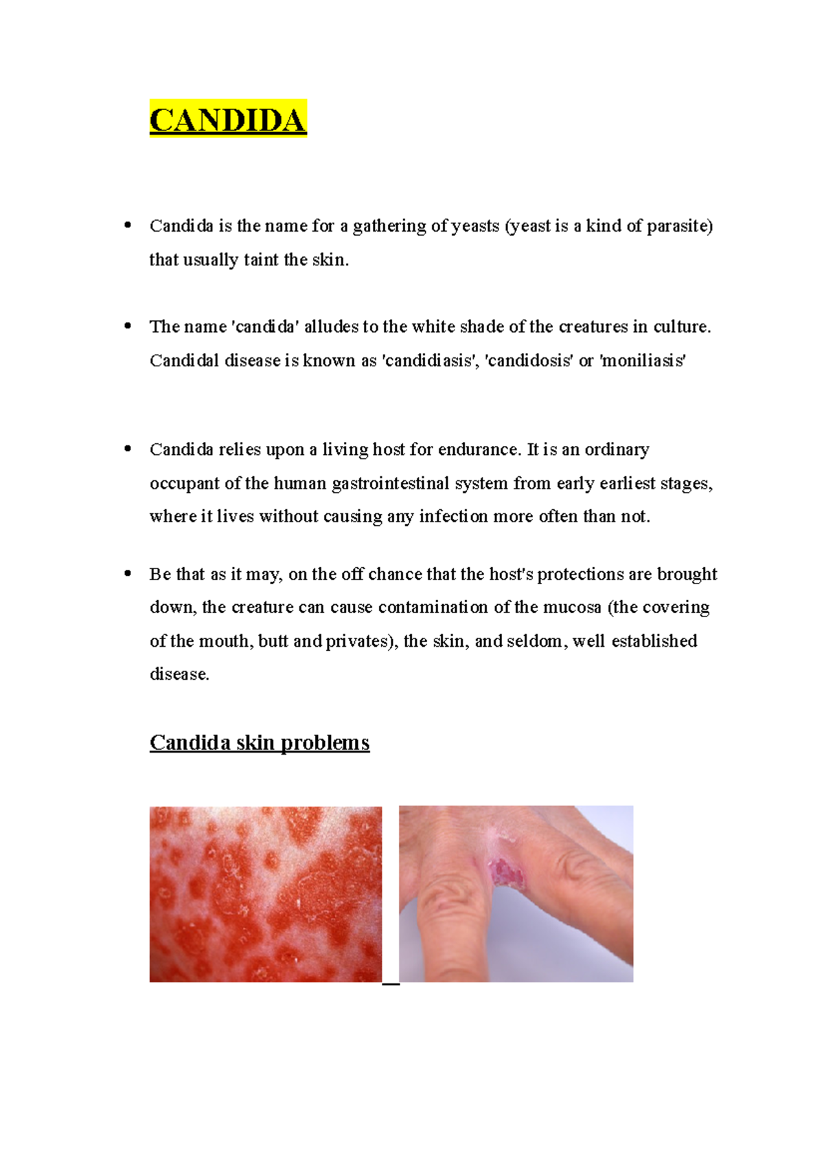 Candidiasis Notes Candidiasis CA Candida Albicans, 52% OFF