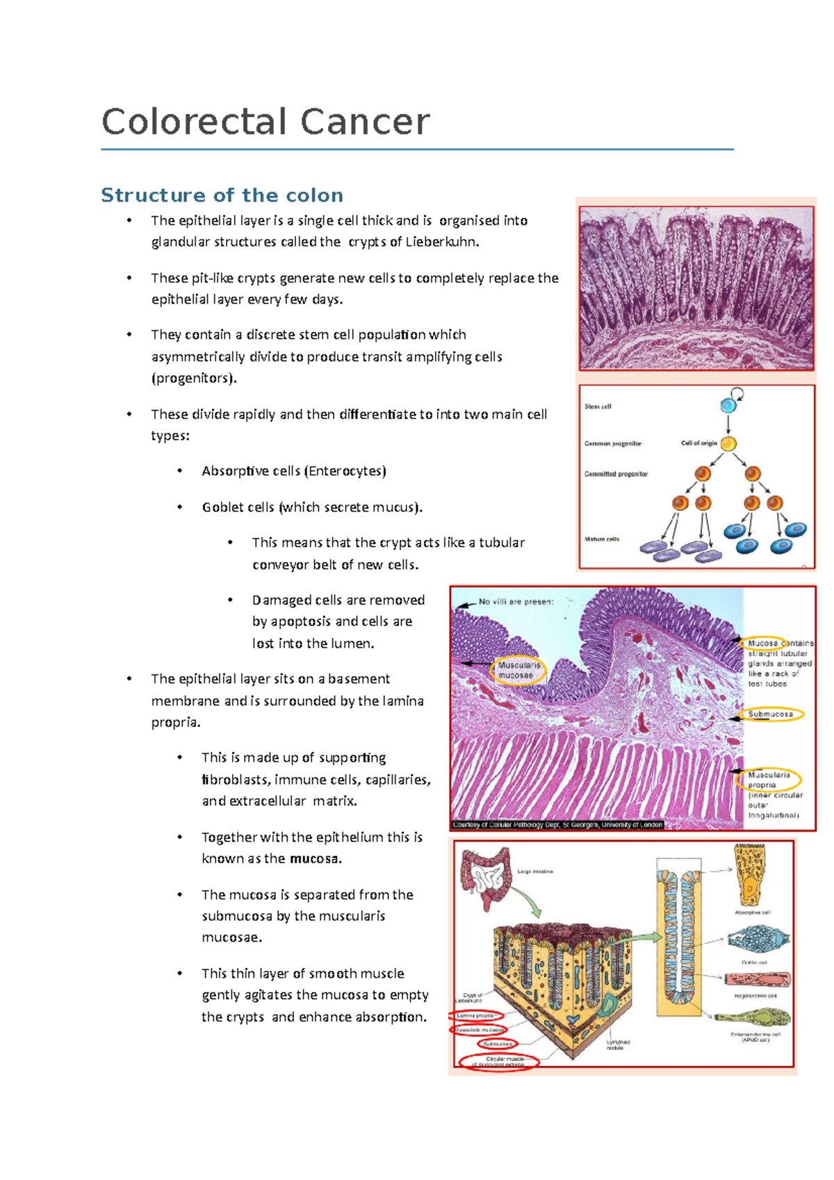 Colorectal Cancer Notes - UWE - Studocu
