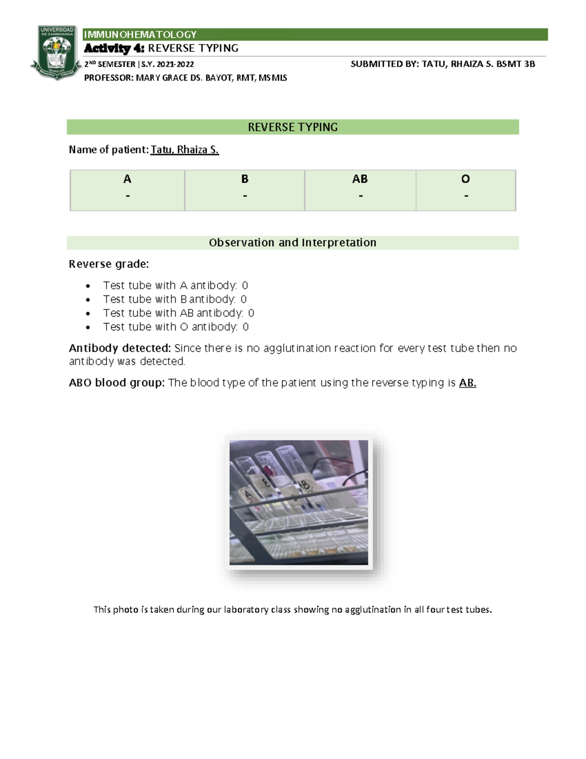 Immunohematology activity 4 - REVERSE TYPING Name of patient: Tatu ...