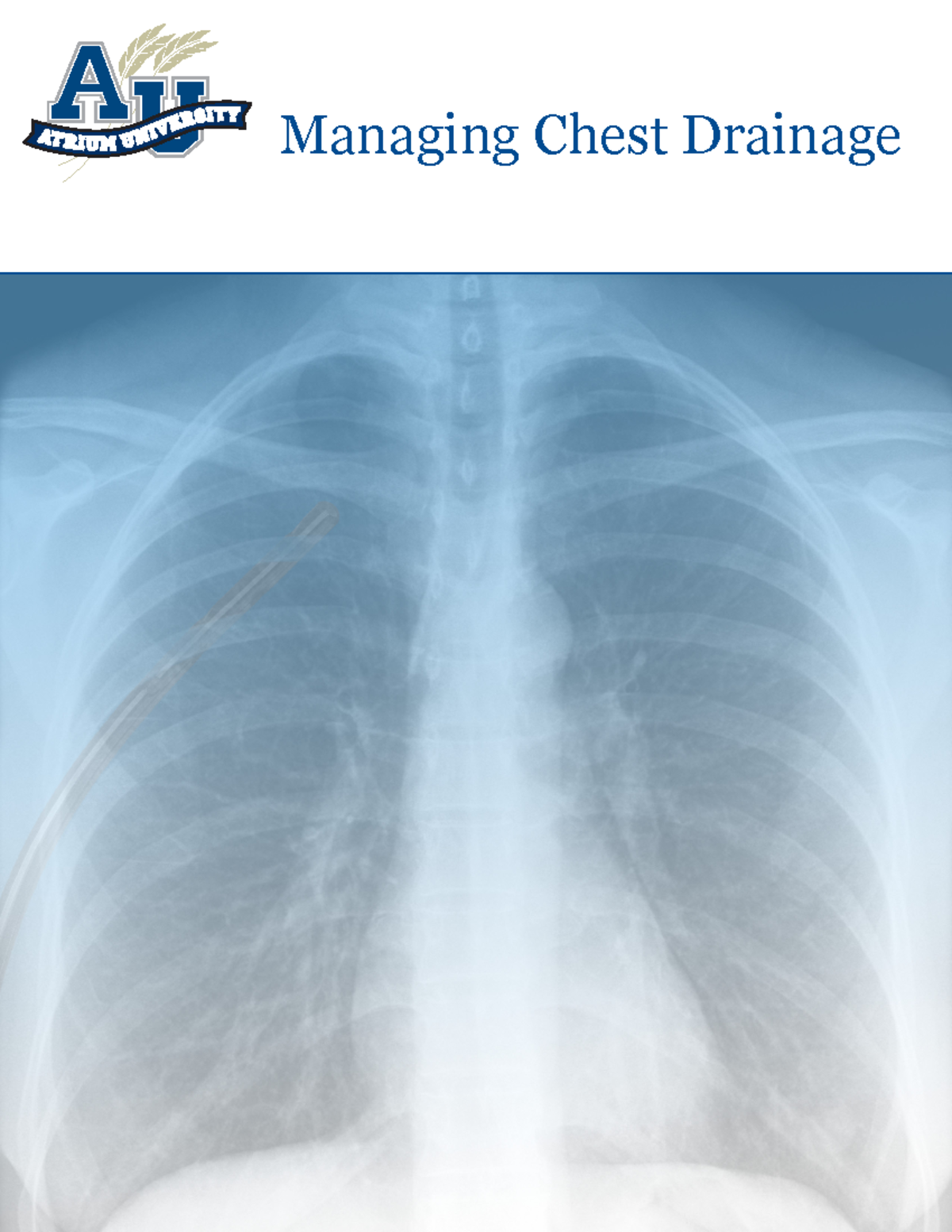 Managing chest drainage atrium med - Managing Chest Drainage Managing ...