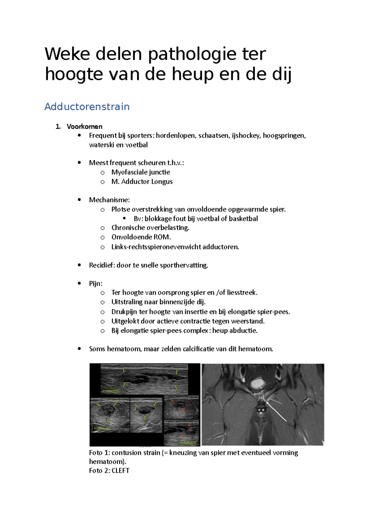 Weke delen pathologie ter hoogte van de heup en de dij - Weke delen ...