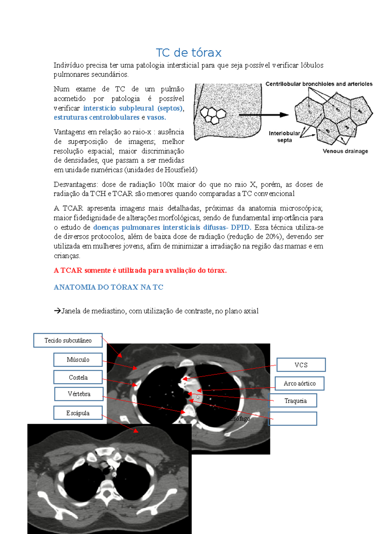 TC DE Tórax - este resumo trata da TC como um método de diagnóstico ...