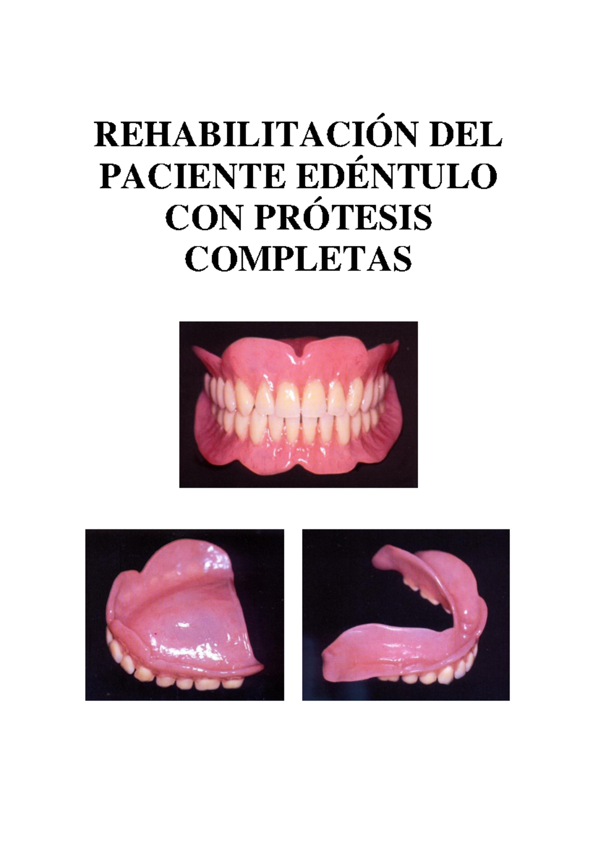 AnatomíA DEL Paciente EDÉ Ntulo - REHABILITACIÓN DEL PACIENTE EDÉNTULO ...