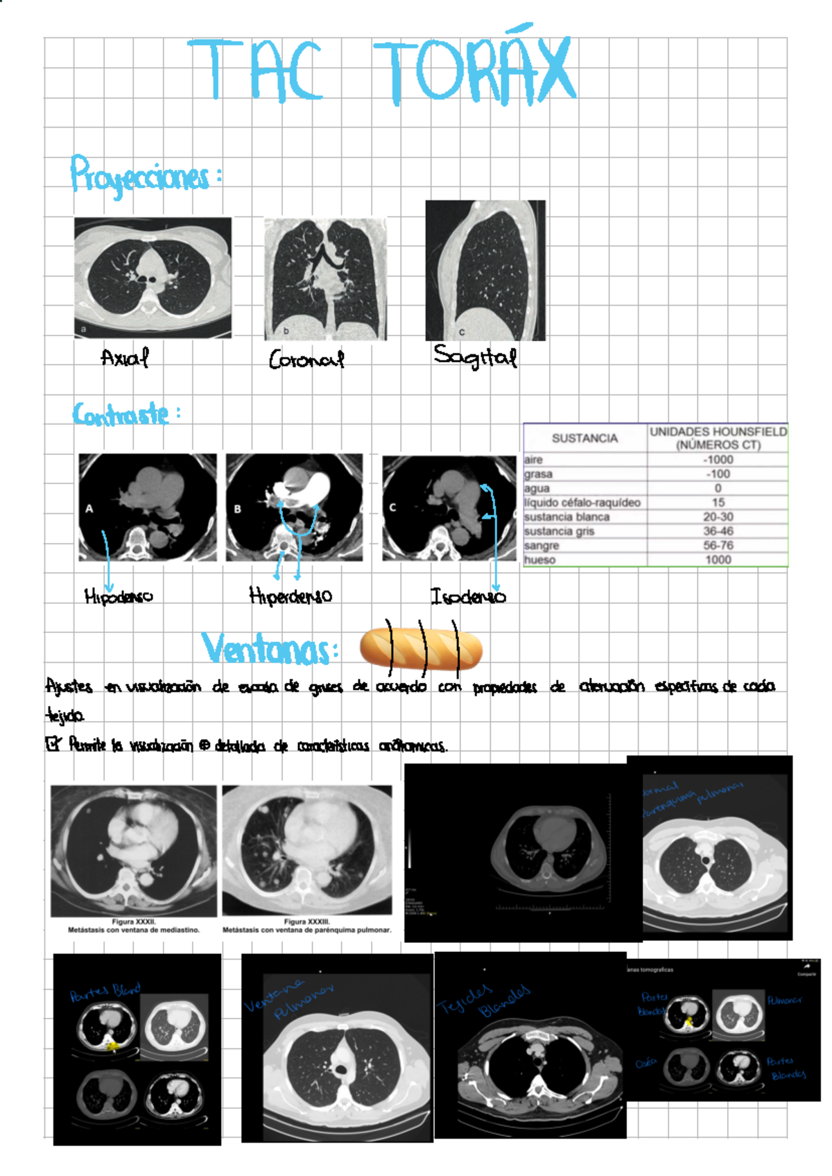 TAC torax - TORAX Proyecciones : b C Axial Coronal Sagital Contraste ...