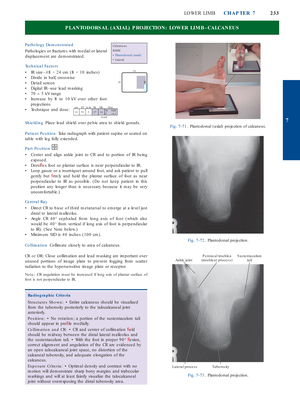 AP OBLIQUE PROJECTION—LATERAL (EXTERNAL) ROTATION: KNEE - No te : A ...