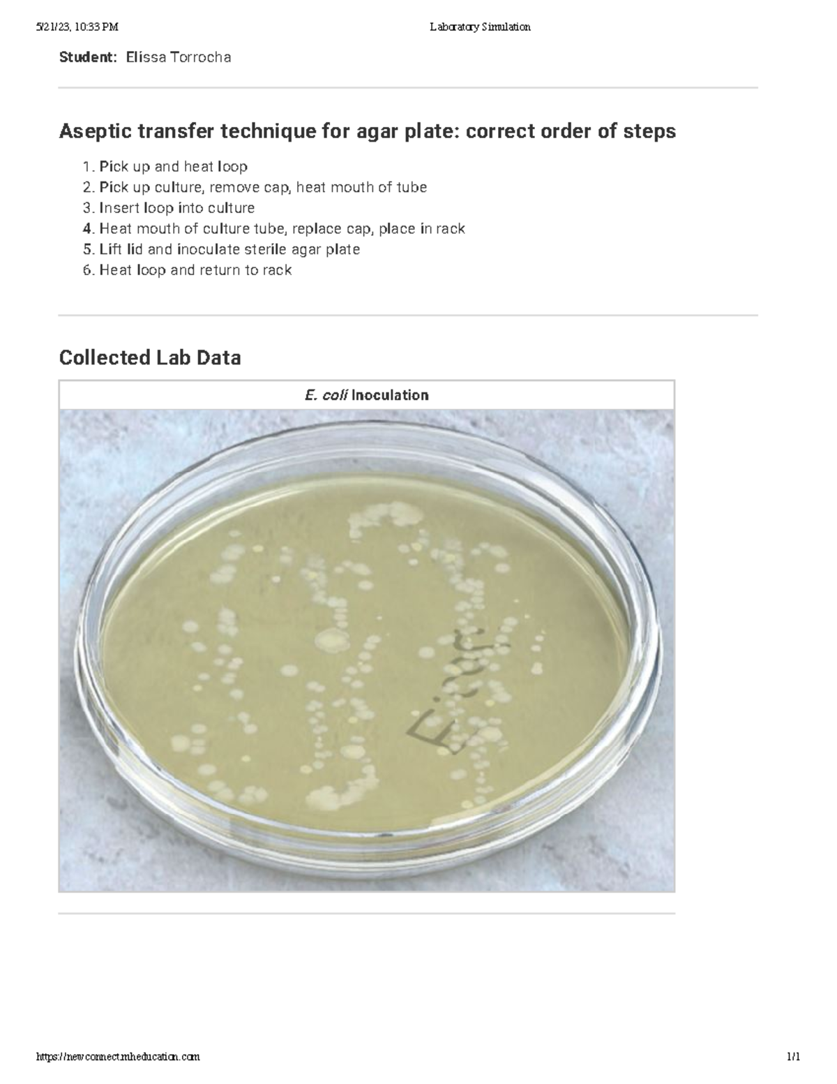 Aseptic Technique - Broth Culture to Sterile Agar Plate - MICRO 290 - 5 ...