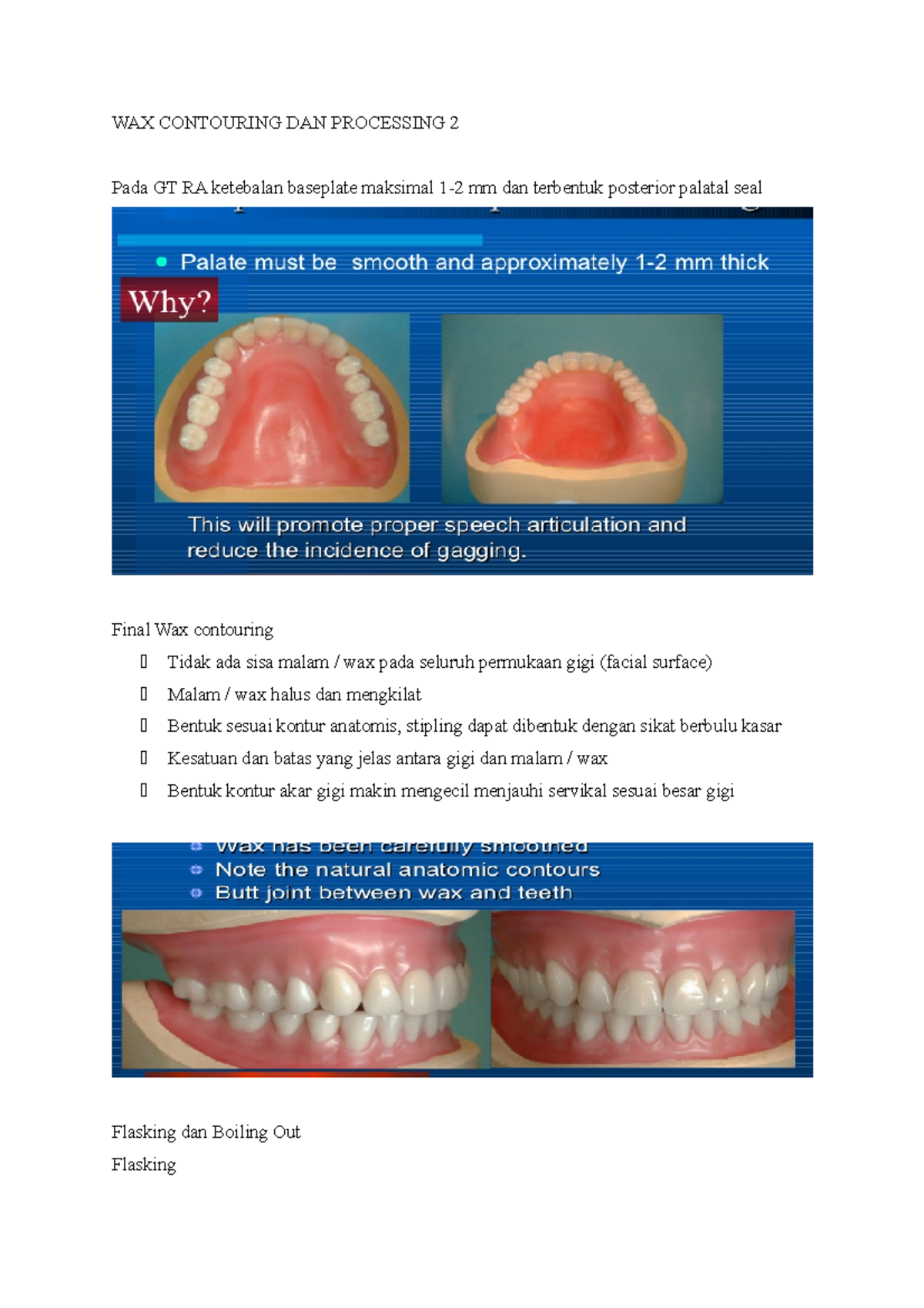 Wax Contouring Dan Processing 2 - WAX CONTOURING DAN PROCESSING 2 Pada ...
