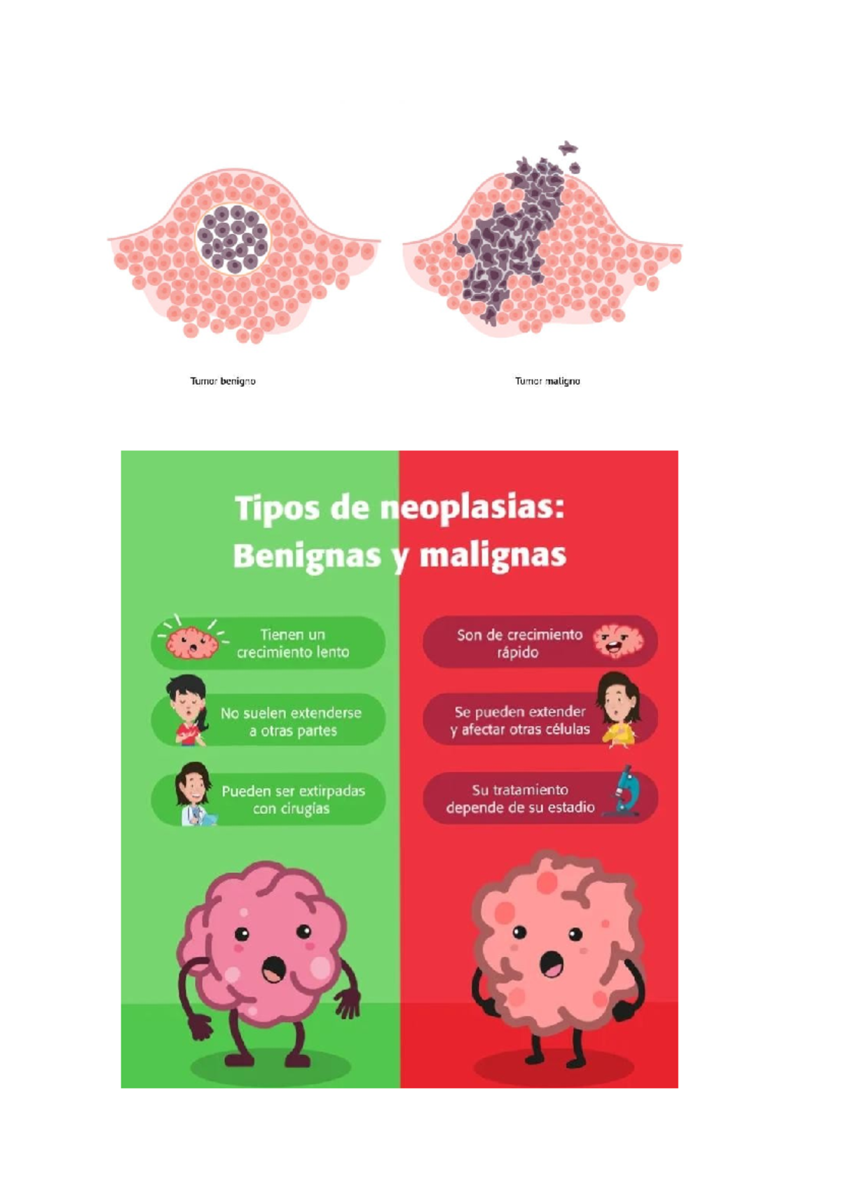 Neoplasia - Tumor benigno Tumor maligno Tipos de neoplasias: Benignas y ...