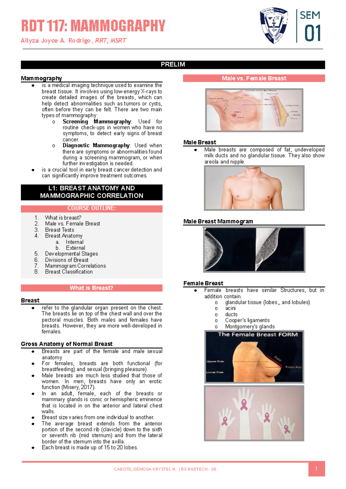 RDT 117 Mammography - RDT 117: MAMMOGRAPHY Allyza Joyce A. Rodrigo, RRT ...