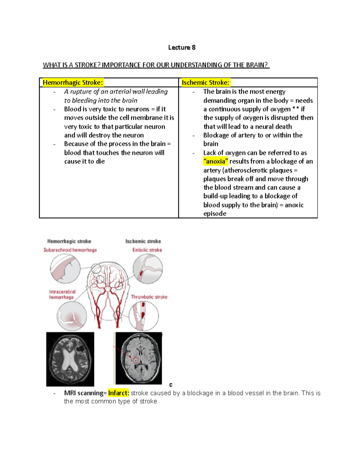 Lecture 8 Notes - Lecture 8 WHAT IS A STROKE? IMPORTANCE FOR OUR ...