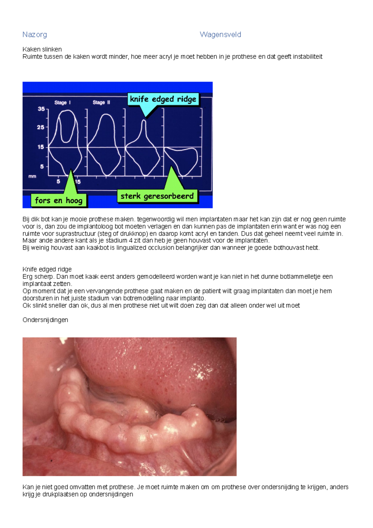 Nazorg - tegenwoordig wil men implantaten maar het kan zijn dat er nog ...