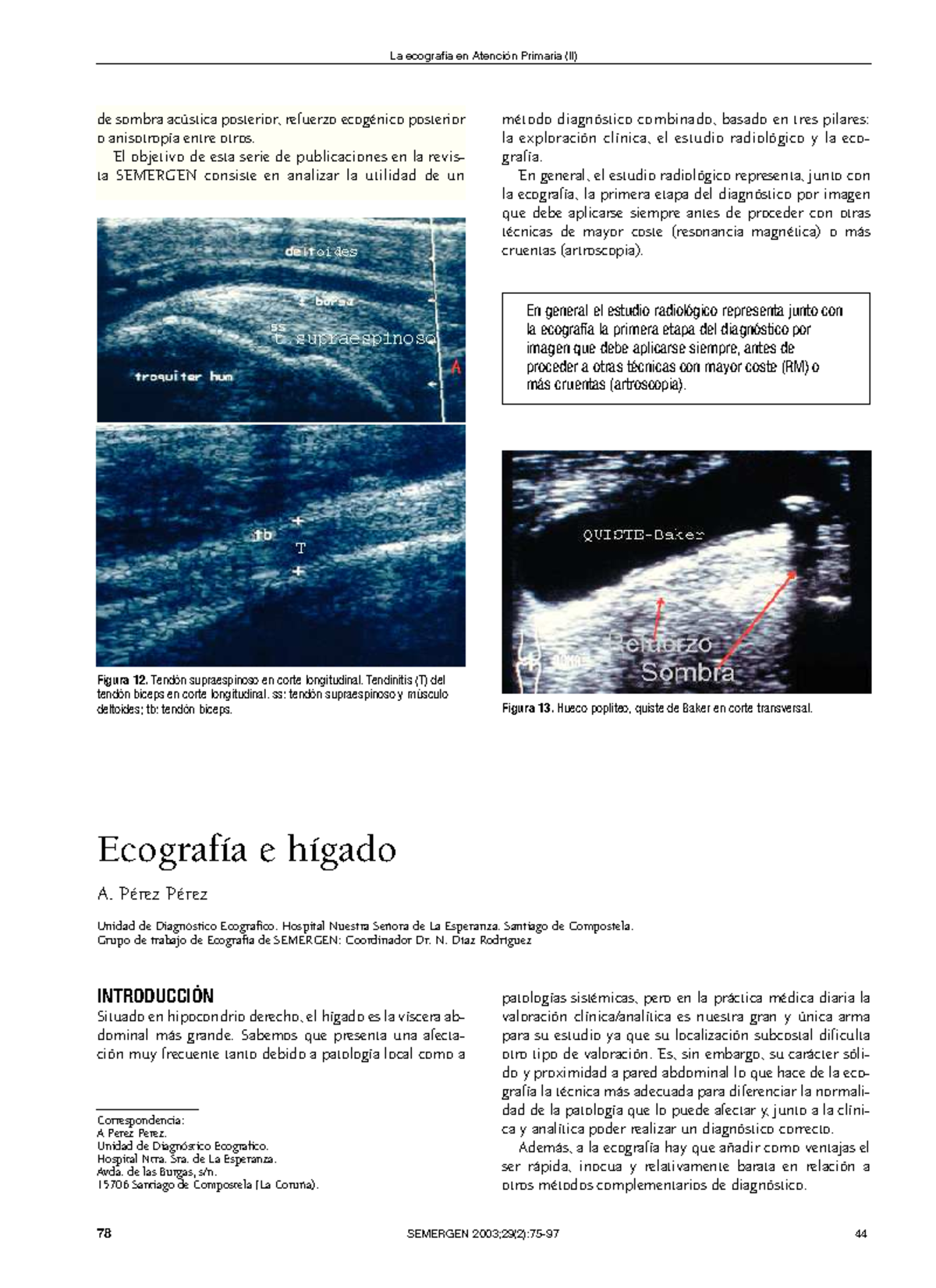 S113835930374163 X - de sombra acústica posterior, refuerzo ecogénico ...
