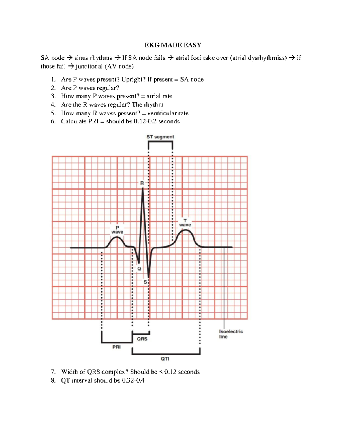 Ekg guide and rhythms - EKG MADE EASY SA node → sinus rhythms → If SA ...
