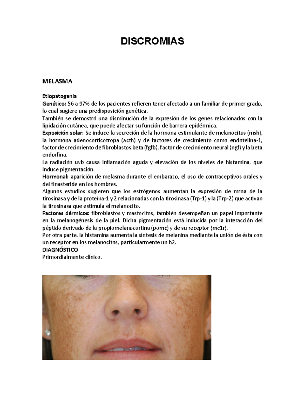Discromias - DISCROMIAS MELASMA Etiopatogenia Genético: 56 a de los ...