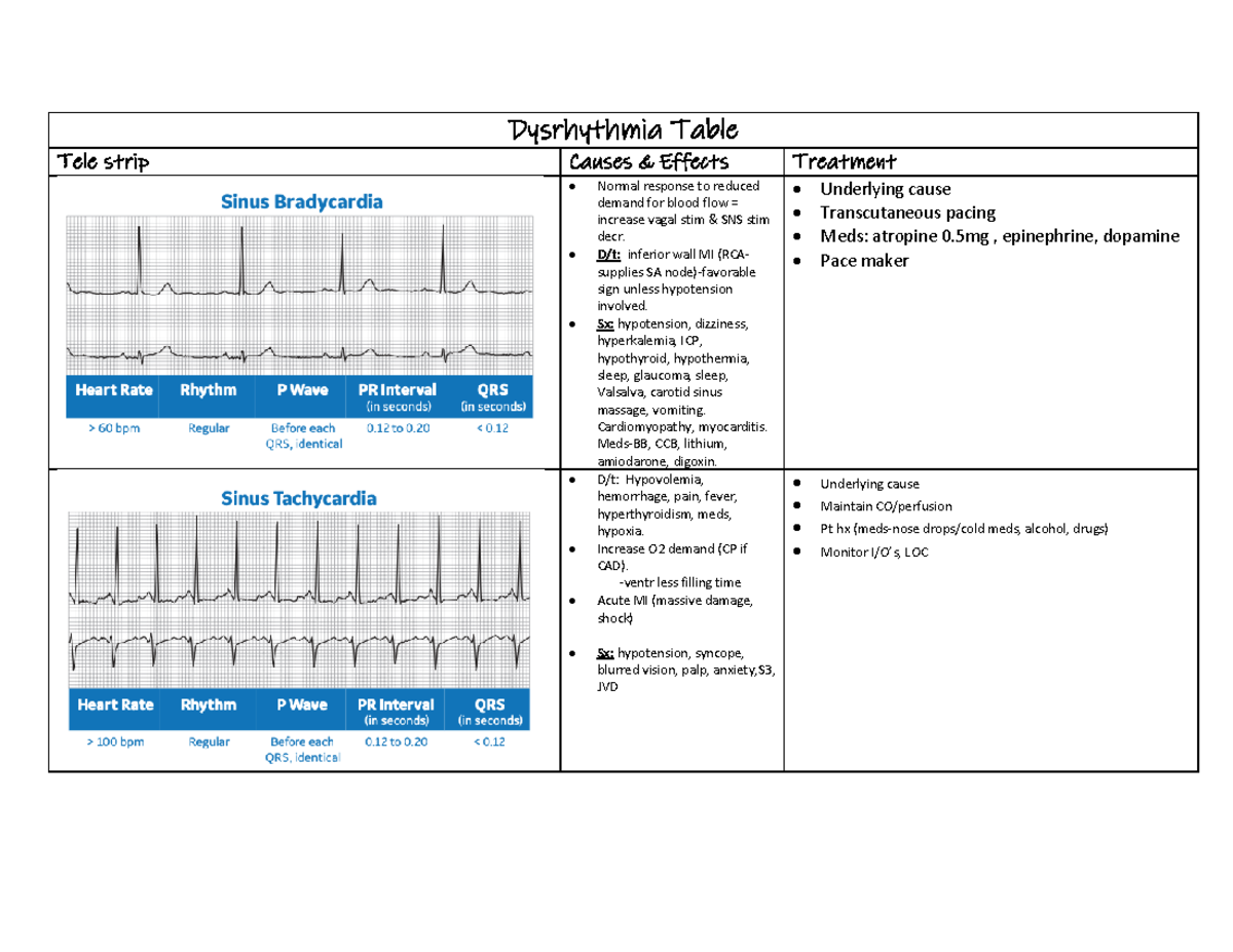 Dysrhythmias Table - Dysrhythmia Table Tele strip Causes & Effects ...