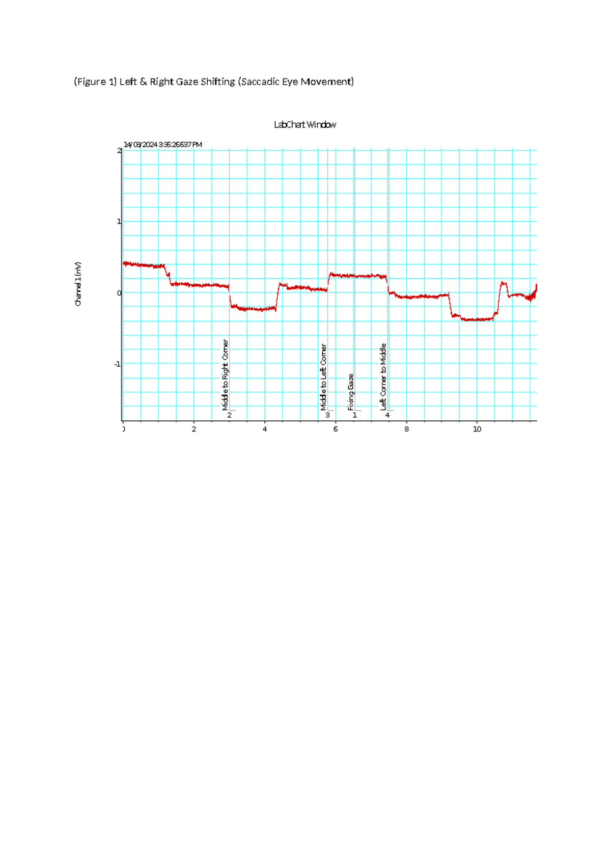 Eye Movement - BIO1004 PHYS Graph - (Figure 1) Left & Right Gaze ...