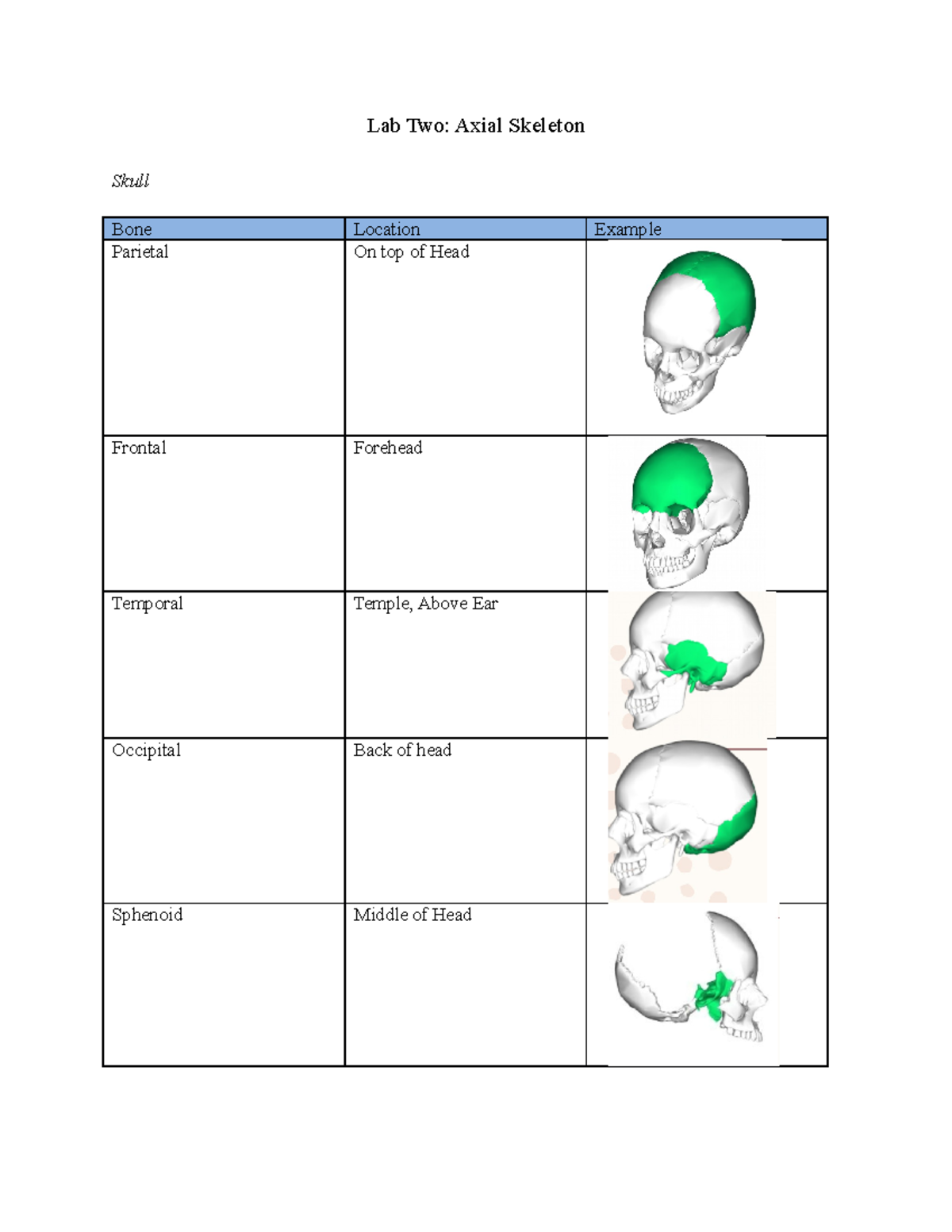 Anatomy Lab 2 - Lab 2 - Lab Two: Axial Skeleton Skull Bone Location ...