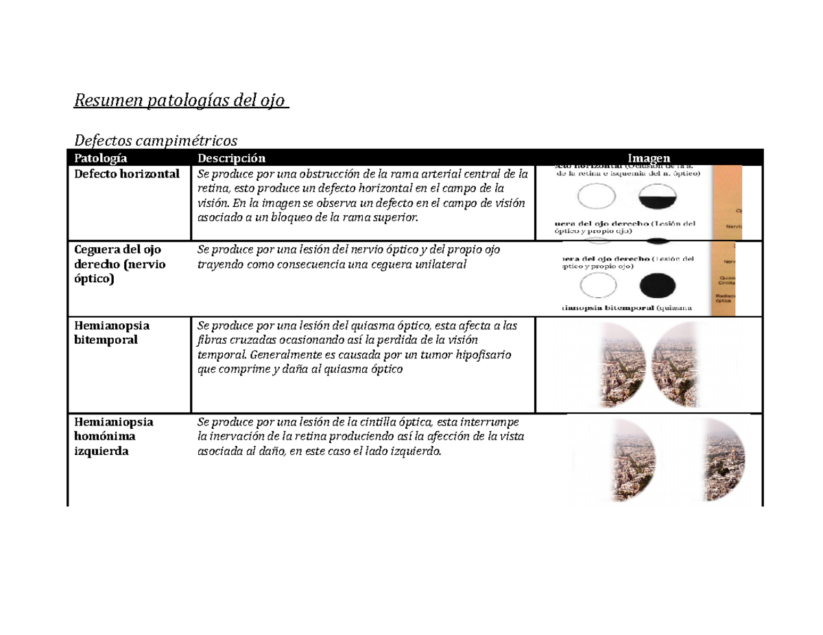 11 Resumen DE Patologias DE OJO - Resumen patologías del ojo Defectos ...