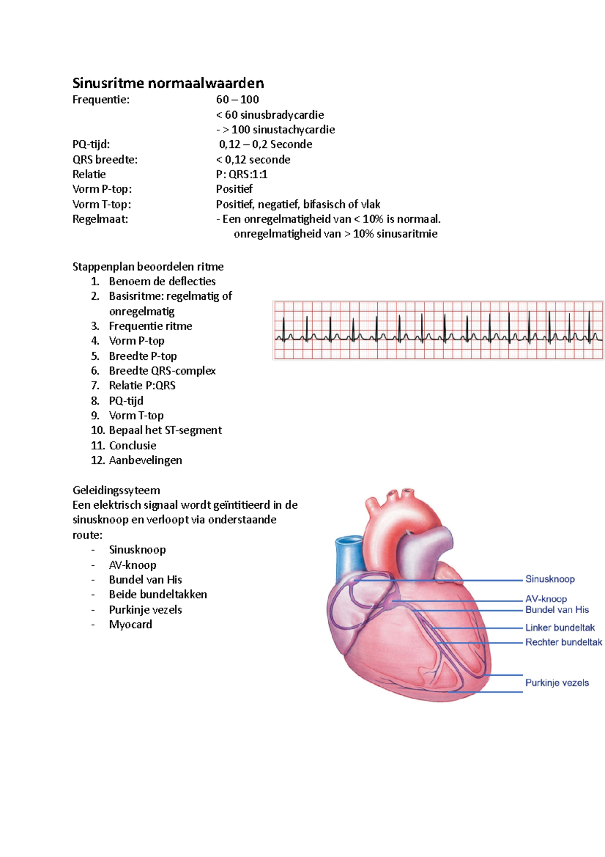 Sinusritme normaalwaarden - Sinusritme normaalwaarden Frequentie: 60 – 100