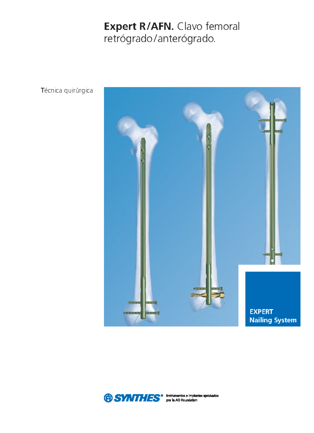 Retrógrado femur - EXPERT Nailing System Técnica quirúrgica Expert R ...