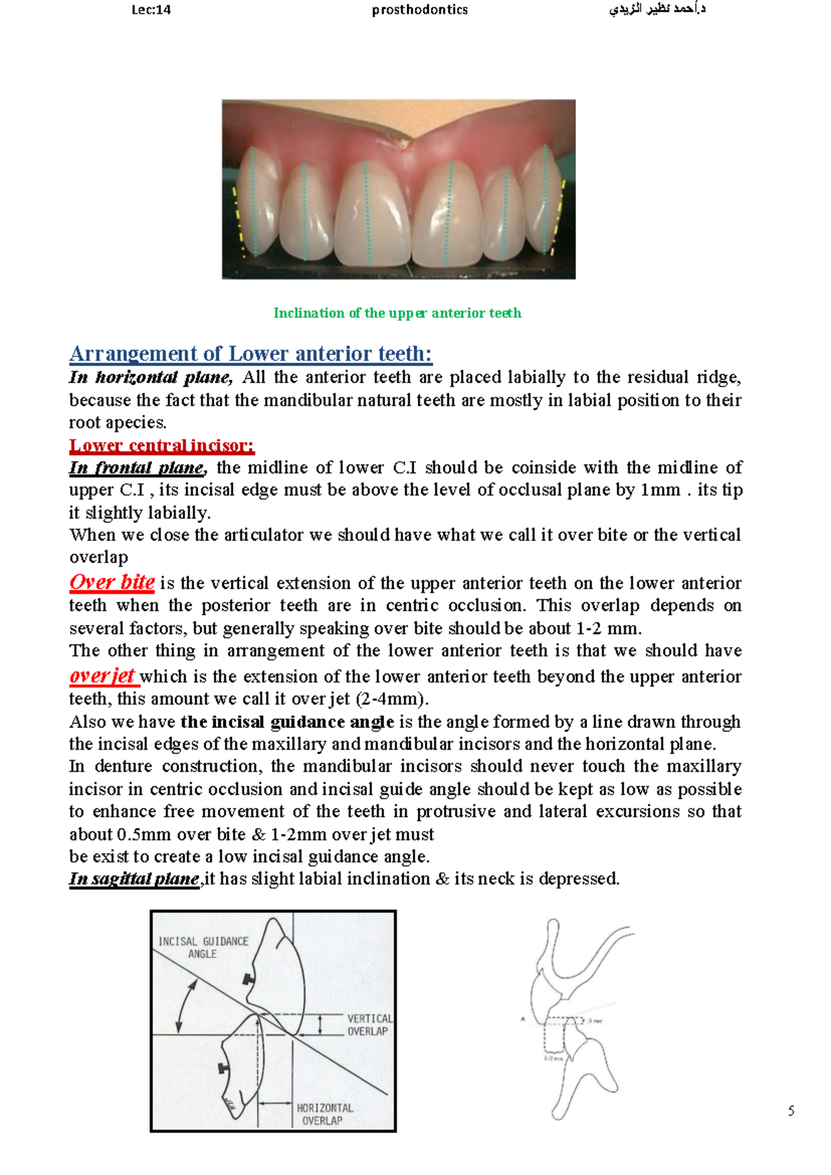 Prosthodontics - Inclination of the upper anterior teeth Arrangement of ...