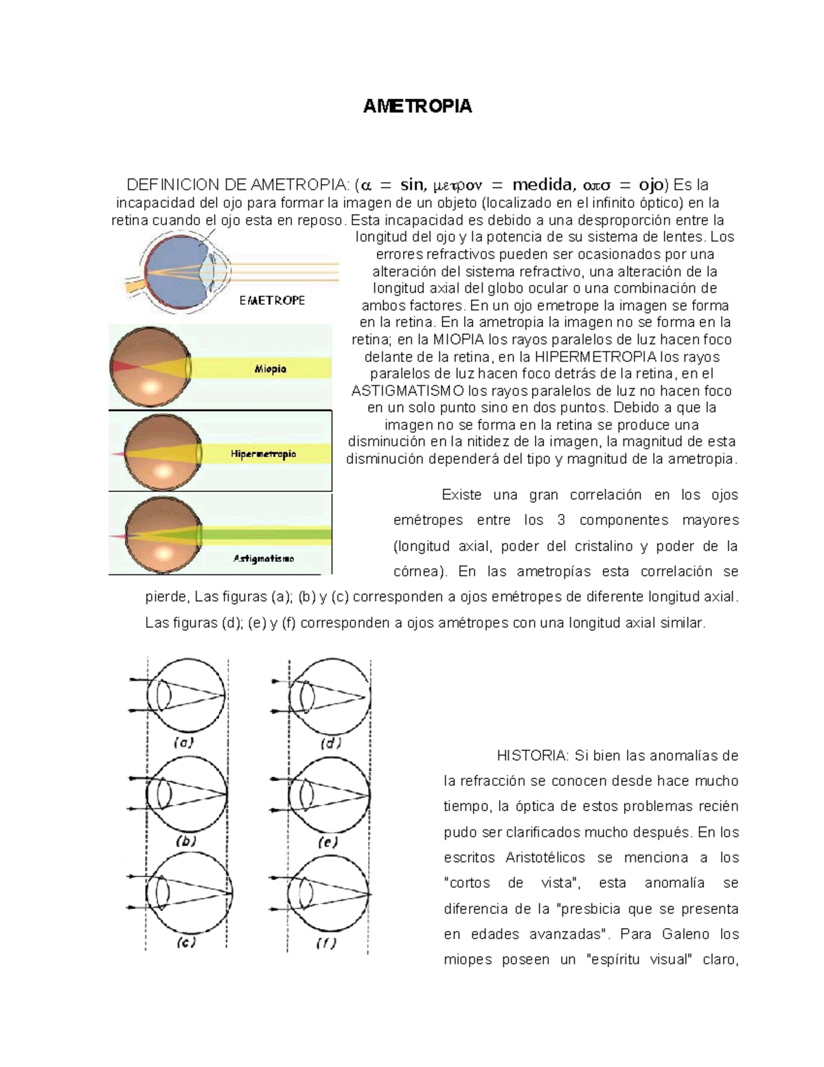 Ametropias . WORD - MIOPIA, HIPERMETROPIA Y ASTIGMATISMO - AMETROPIA ...