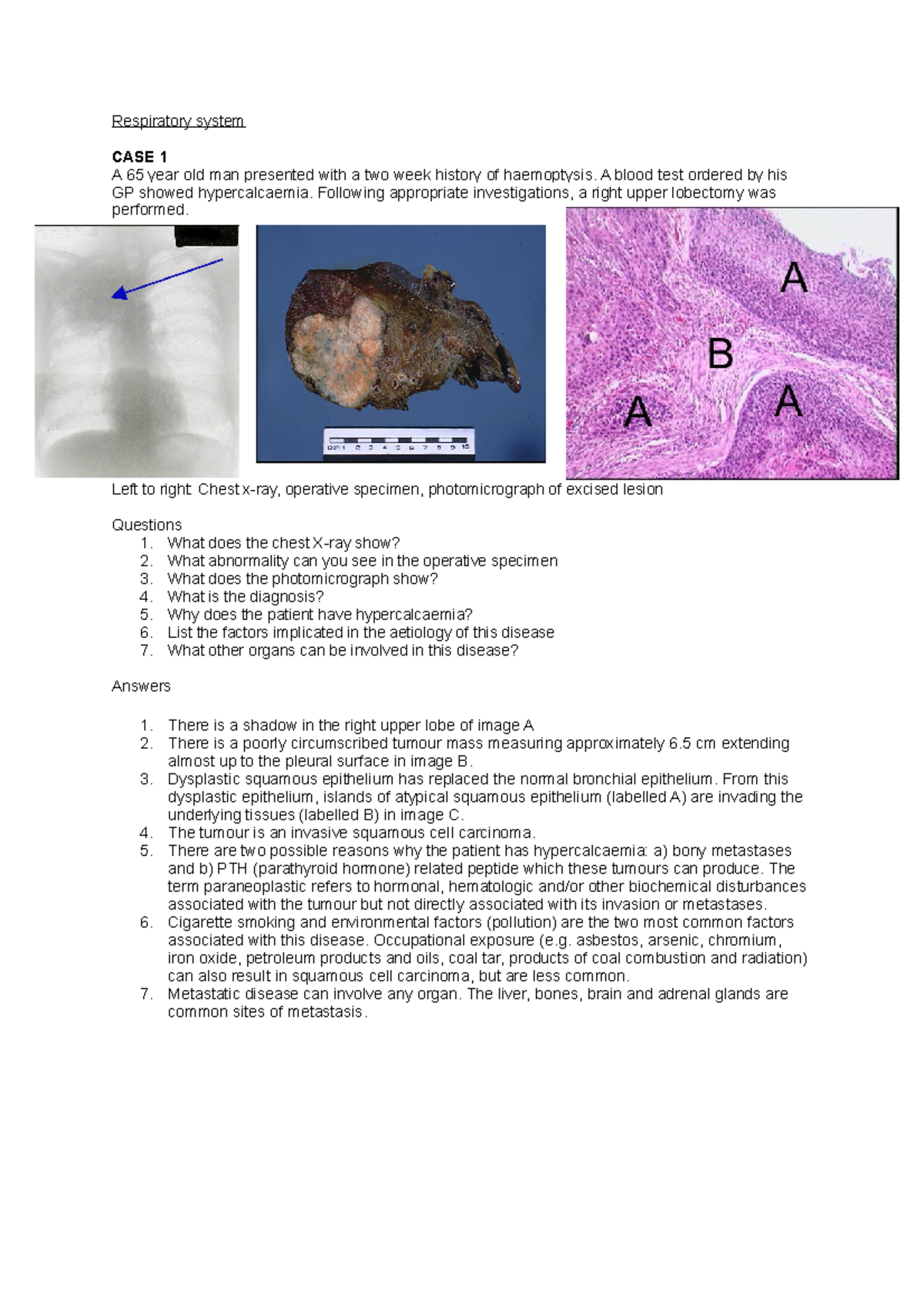 Y2 CR case study questions - Respiratory system CASE 1 A 65 year old ...