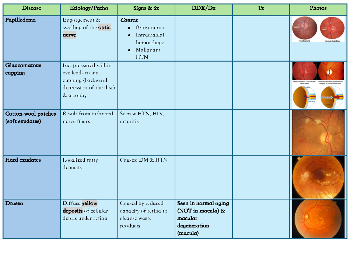 Opthalmology Study Guide - Papilledema Engorgement & swelling of the ...