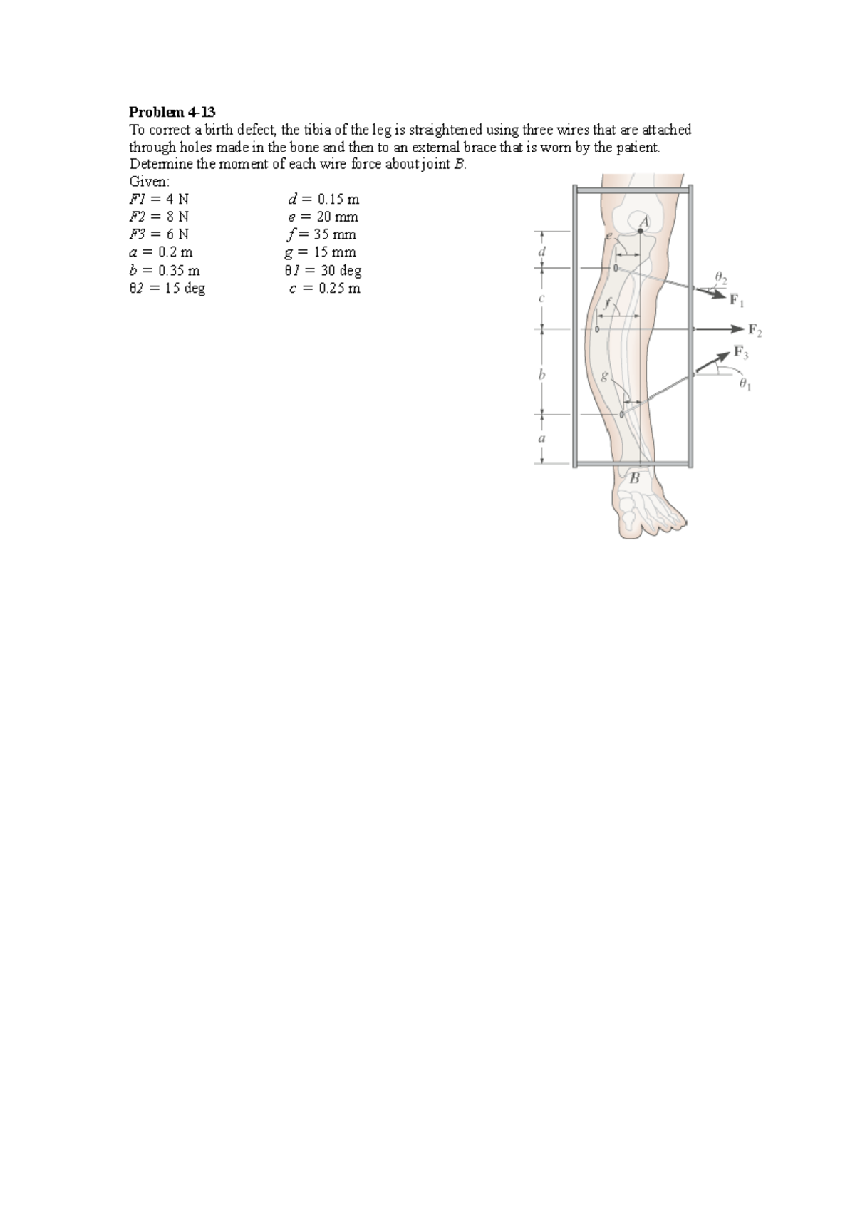 Hw ch4 - Problem 4- To correct a birth defect, the tibia of the leg is ...