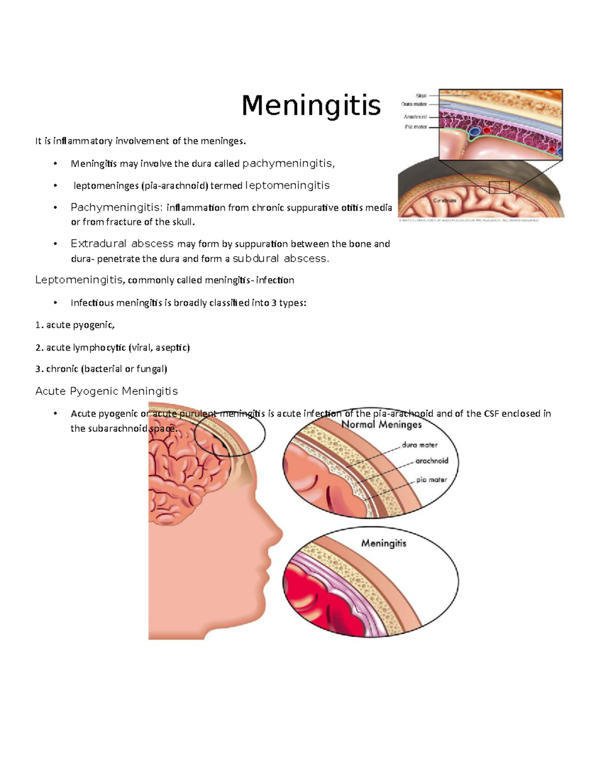 Chapter - 27 Meningitis - Meningitis It is inflammatory involvement of ...