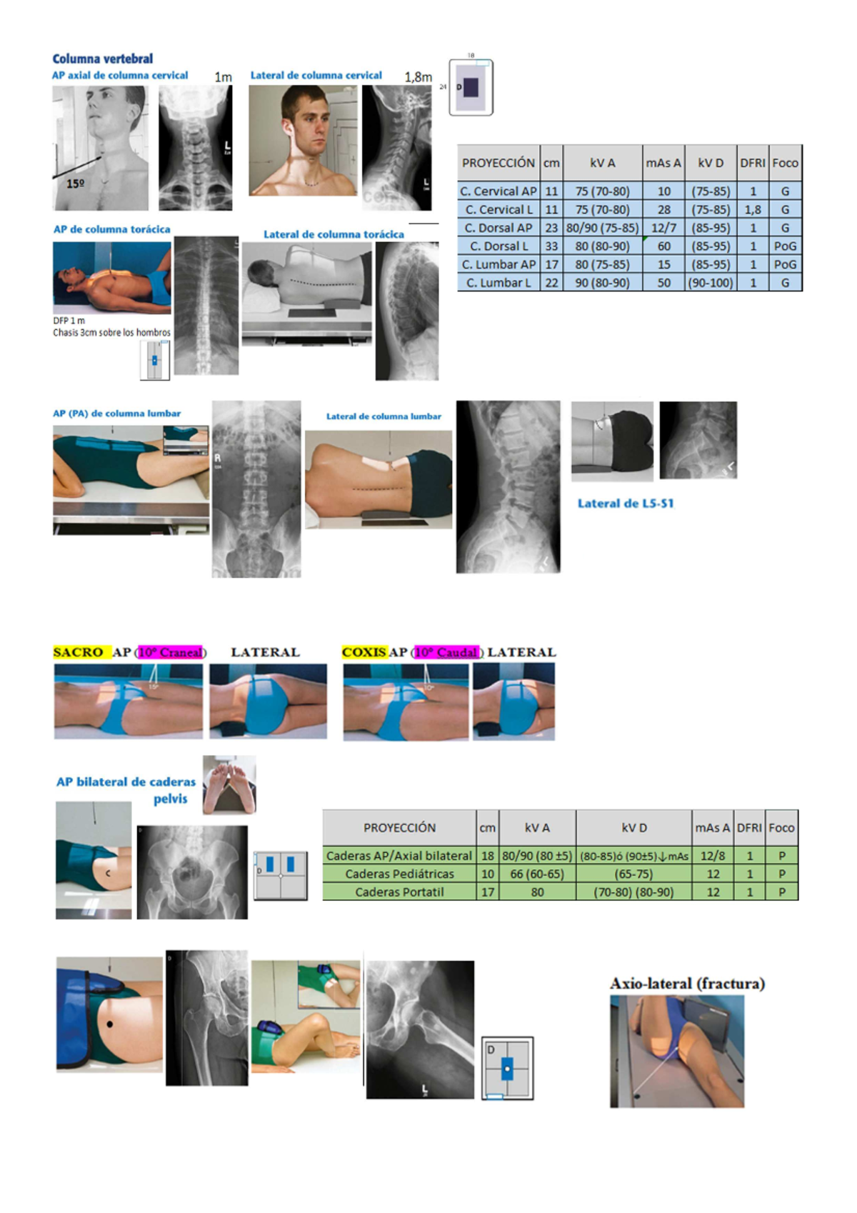 2 Columna y pelvis bolsillo final - Columna vertebral 18 AP axial de ...