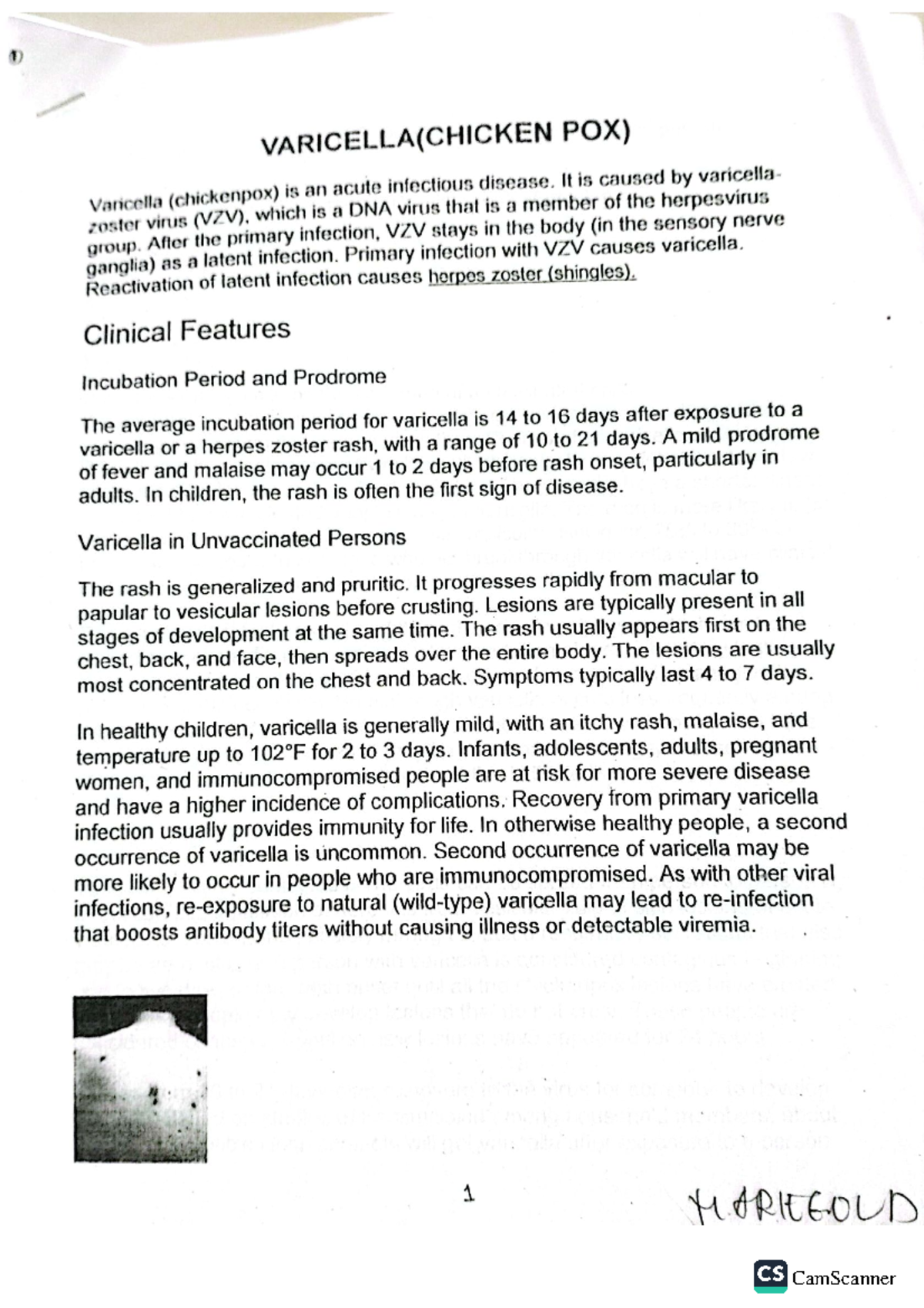 Varicella - Virology - Medical Laboratory Science - Studocu